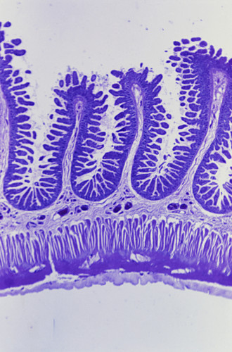 Ileum Bilder Science Photo Library