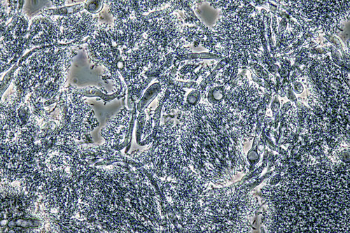 Mundsoor Bilder Science Photo Library