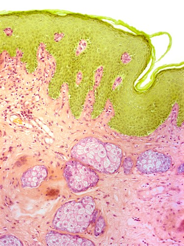 Weibliche Genitalien Bilder Science Photo Library