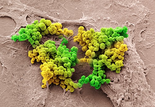 Staphylocoque doré Photos Science Photo Library