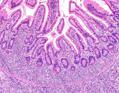 Ileum Bilder Science Photo Library