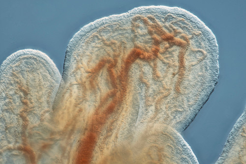 Trompe de Fallope Photos Science Photo Library