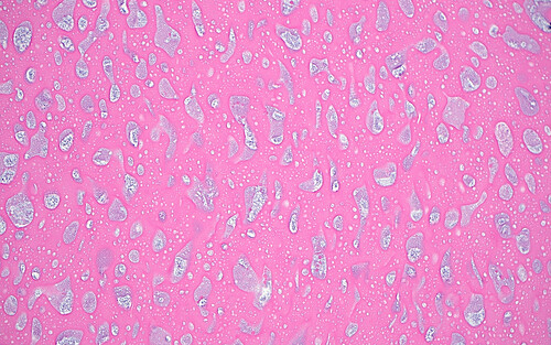 Testicules Photos Science Photo Library