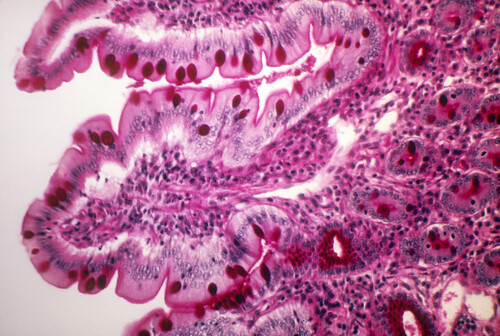 Membrane muqueuse Photos Science Photo Library