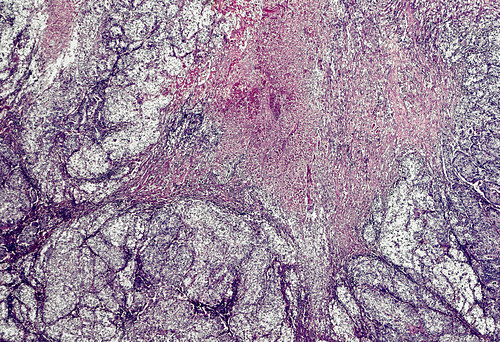 Testicules Photos Science Photo Library