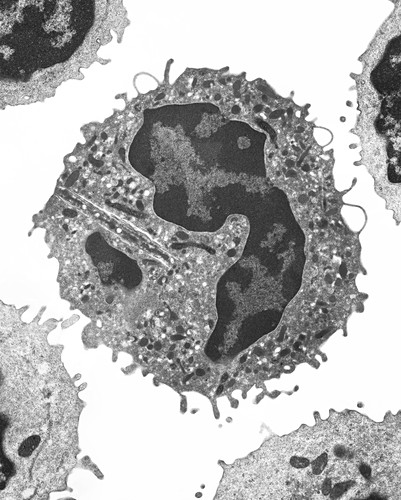 Tem Bilder Science Photo Library