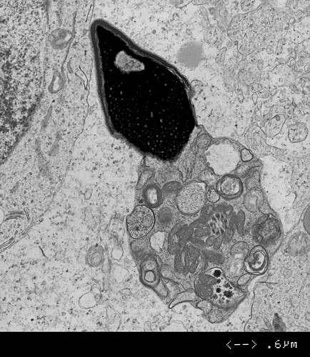 Testicules Photos Science Photo Library