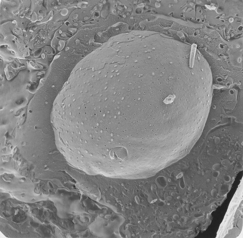 Bilder Science Photo Library